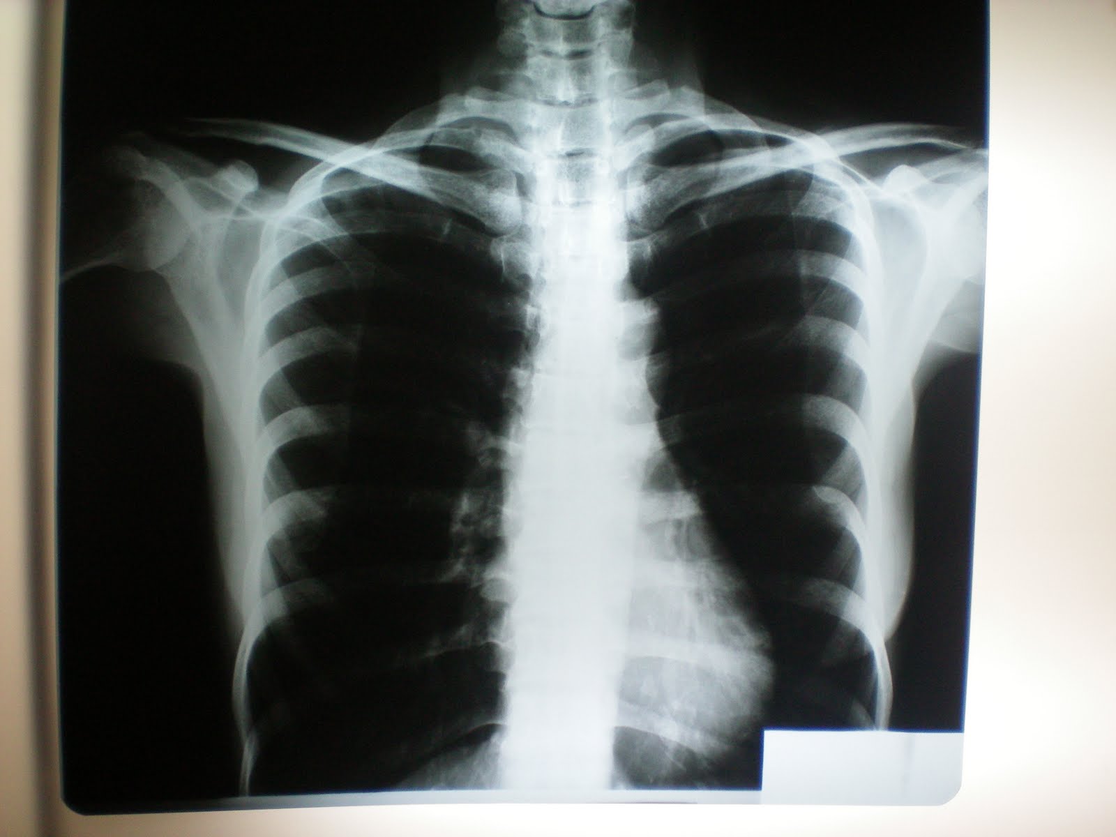 RXDOMINICOS: 09/13/10