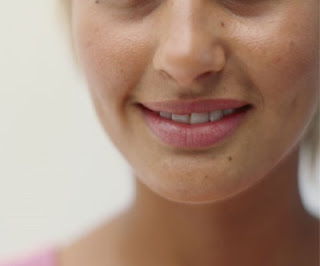 Só Lindos tem Chance: Muitas pintas na pele - pele que envelhece menos