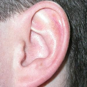 la fonoaudiologia: EL OIDO