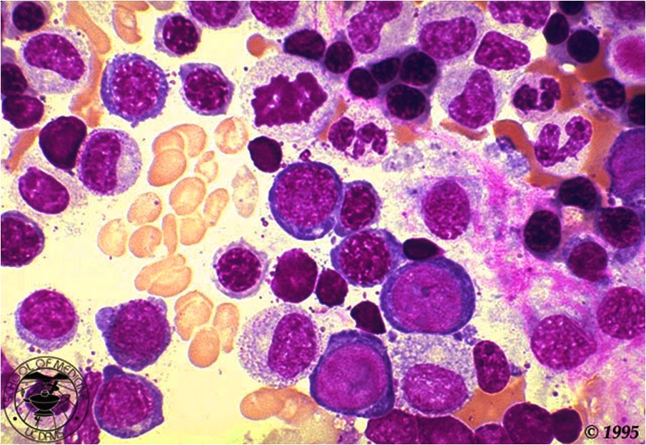 ATLAS DE HEMATOLOGIA: GLOBULOS ROJOS
