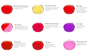 Microbiology / New discoveries: CULTURE MEDIA AND ITS TYPES USED UN ...