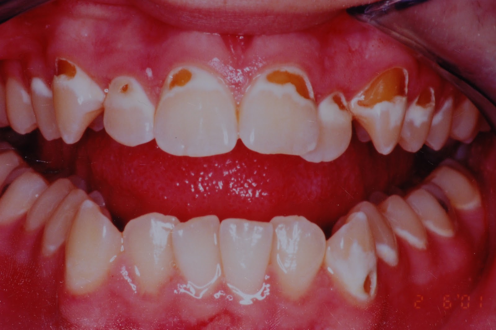 Spit Happens: January 2011