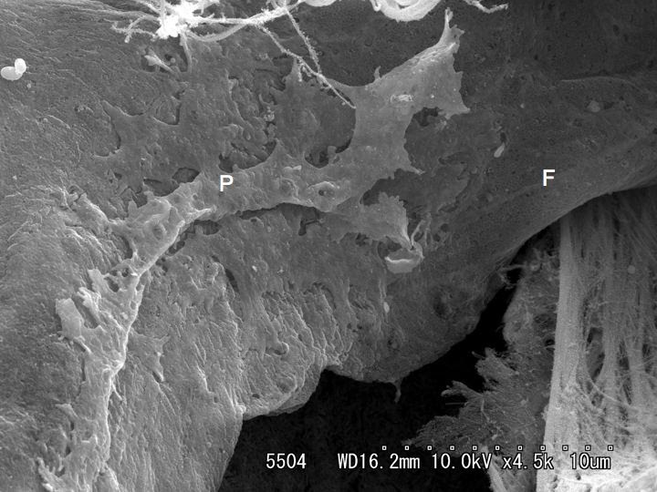 Blood vessels of eyes: Pericyte process and fenestrated endothelial ...