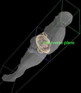 Software Libre y Algo Más: Orientación anatómica