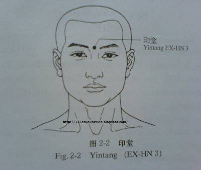 123 Acupuncture-Moxibustion Therapies