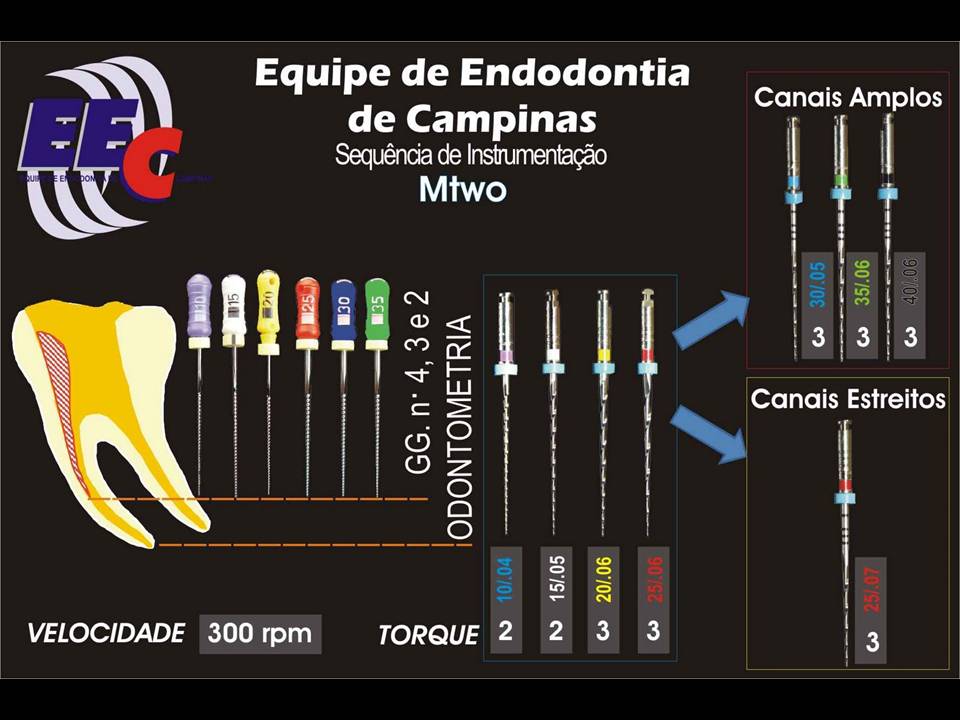 Endodontia Dr. Henrique Braitt: Sequência de instrumentação MTwo ...