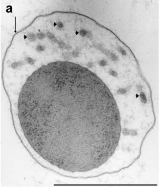 Microwunderkammer: Insane in the (Outer) membrane