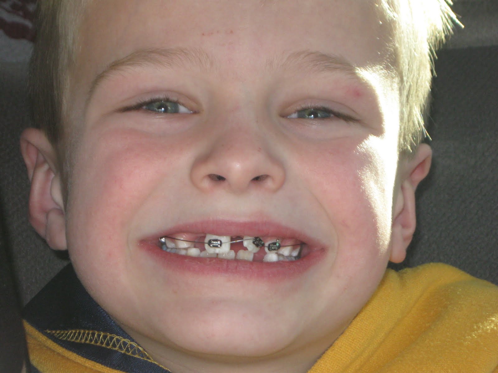 WACKY WESTWOODS: Look who got braces