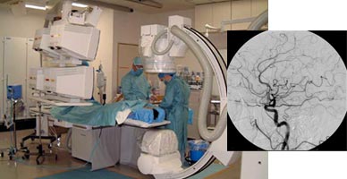 Angiografi Pembuluh Darah Otak (Angiography Cerebral) - Terapi Sehat ...