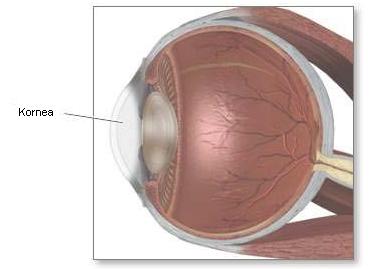 Riyan Sudrajad: ASKEP ULKUS KORNEA