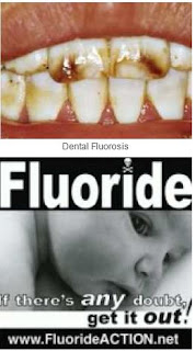 Biochemistry Den: Why is Fluoride Bad for You?