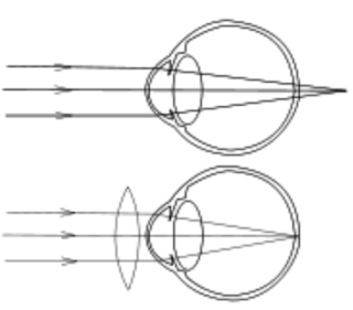 Ochiul: Tratare Teoretica