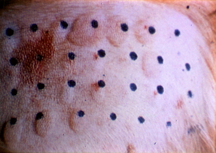 Imuno Natural Killer