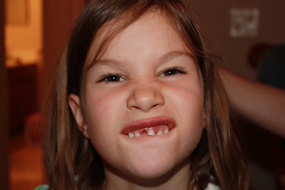 I AM WONDER WOMAN?: Snaggletooth Sydney