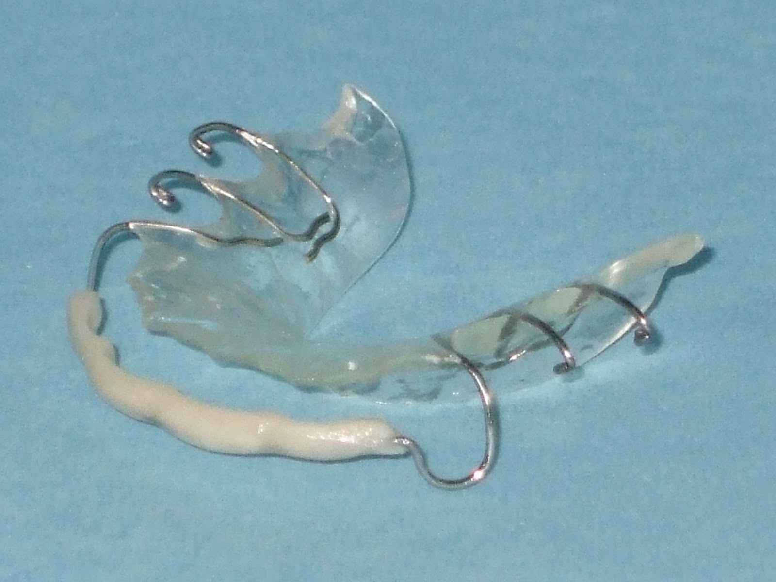 Laboratorio Ortodontico MRdental: Dispositivi di Contenzione