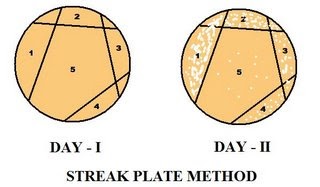 Principle Microbiology: Streak plate method