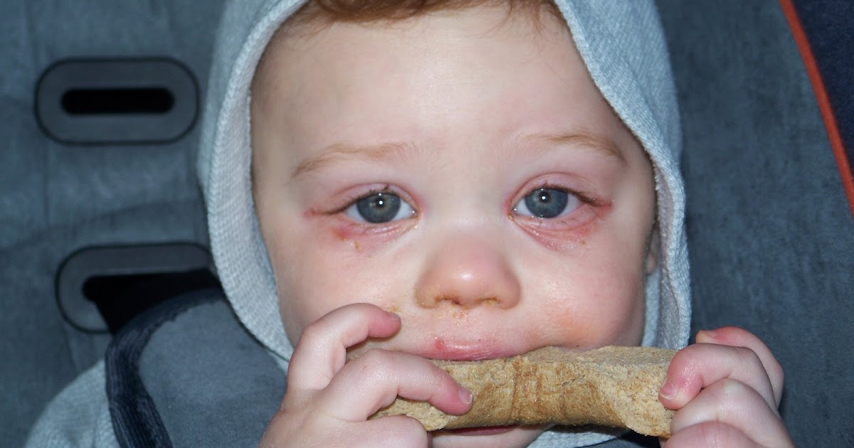 Living In The Park Sick Baby Boy