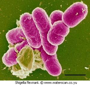 BACTERIOLOGIA: SHIGELLA