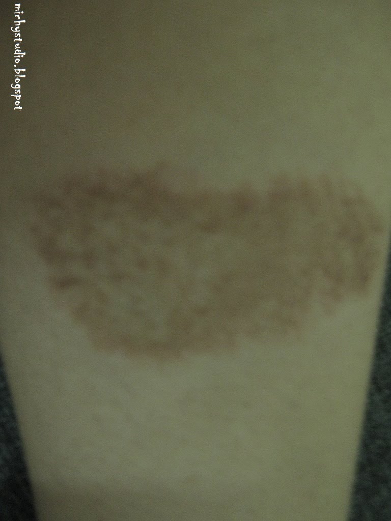 The Pondering Introvert©: Distorted Legs