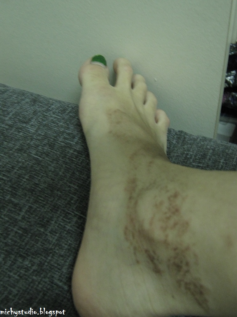 The Pondering Introvert©: Distorted Legs