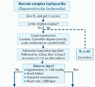 Medicine Easy for Me.: Principles of management Narrow complex tachycardia