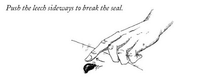 survival kit: How to Remove a Leech