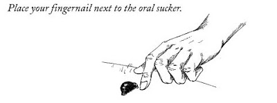 survival kit: How to Remove a Leech