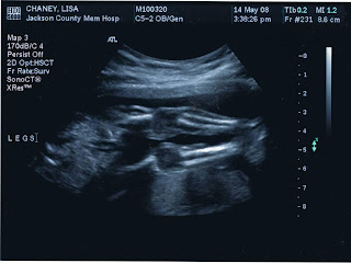 Basically, this is it...: Ultrasound