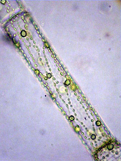 Beyond the Human Eye: Pond scum