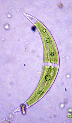 Beyond the Human Eye: Pond scum