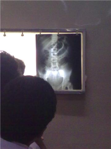 Final Year MBBS: Surgery