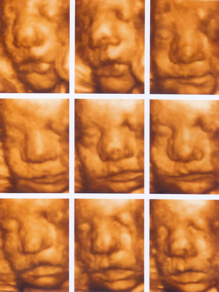 24 weeks pregnant 3d ultrasound - workshopnery