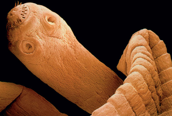 ¿Que son las Tenias?