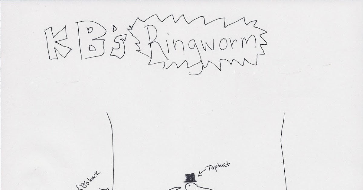 exploraline: Ringworm diagram of a friend's back