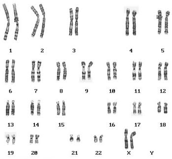Phycology Pharm: Karyogram