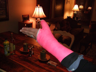 From the Lillypad: The Thumb Spica Cast