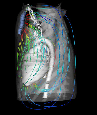 Is Cardiomyopathy ( "weak heart muscle"), and how it is Classified?