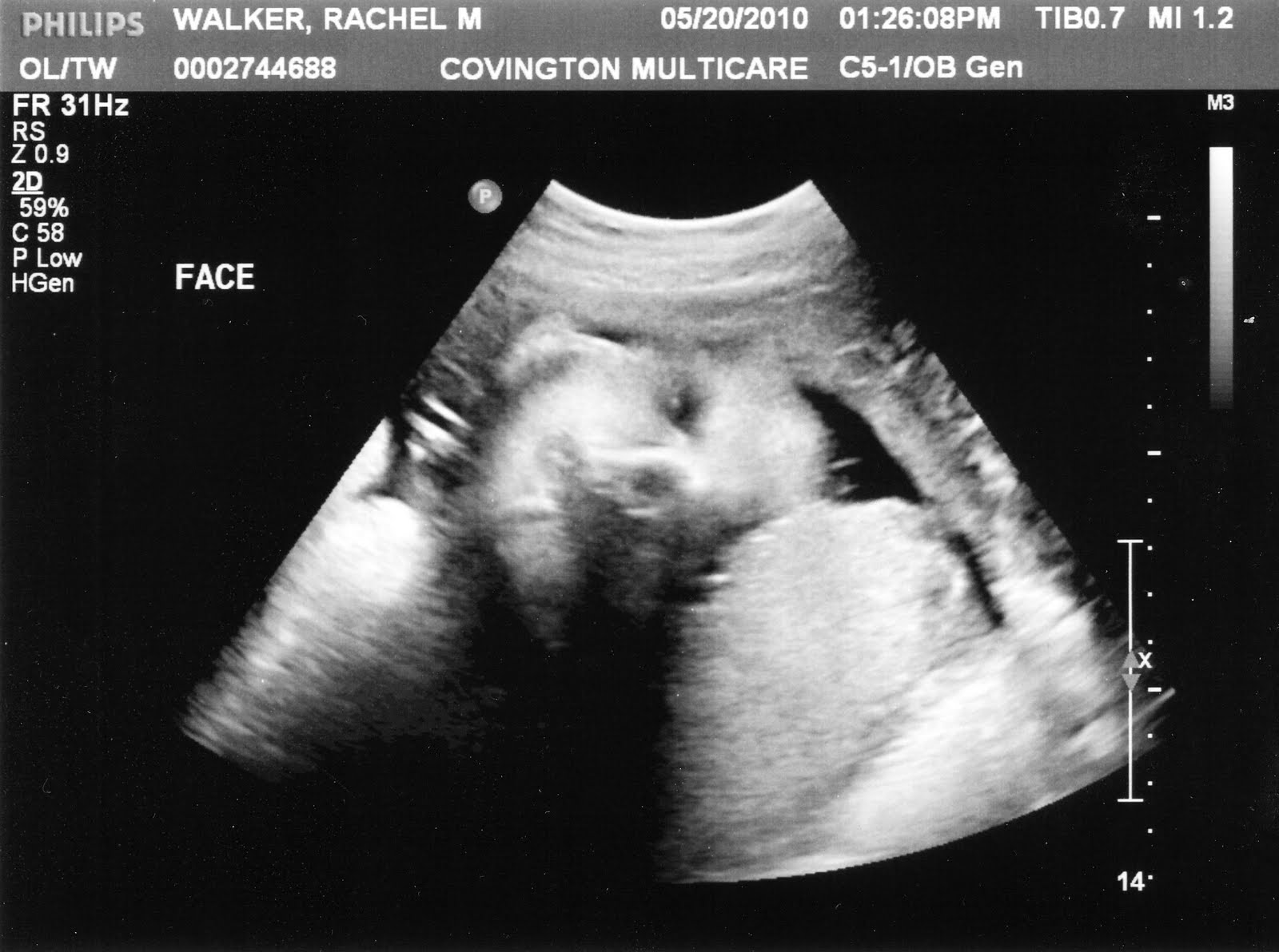 A Life of Surprises: 34 Week Ultrasound