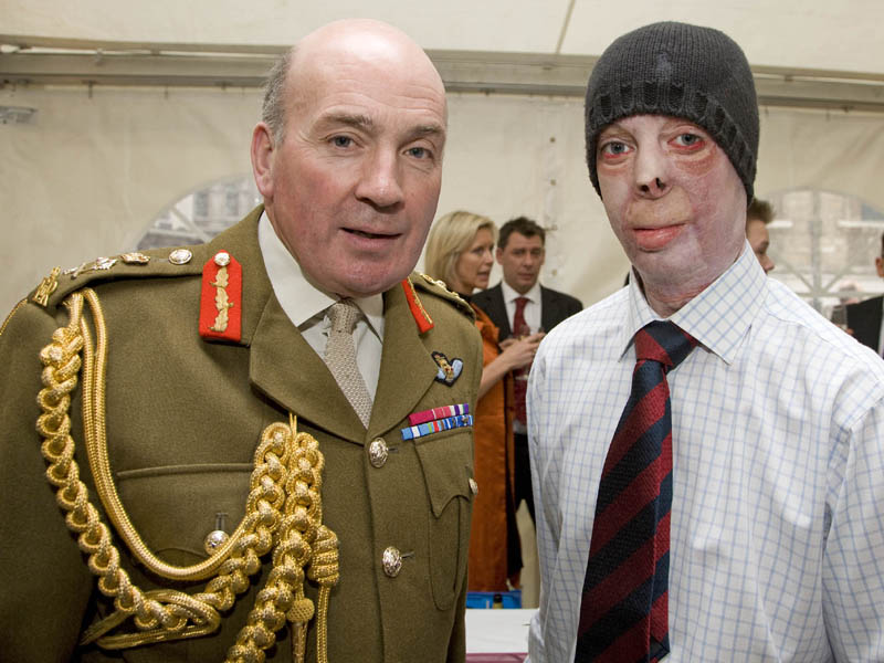 War News Updates: Only The Best For Our Wounded Soldiers (A U.K ...