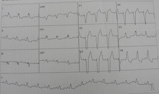 Medicina APS: Hombre de 73 años con Disnea