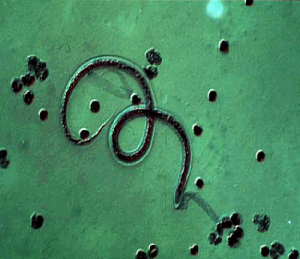 Disease Encyclopedia - List of Diseases and Medical Resource