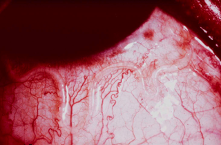 Disease Encyclopedia - List of Diseases and Medical Resource