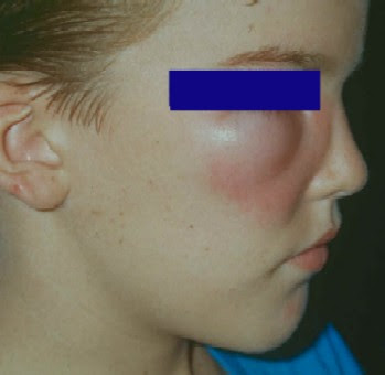 Disease Encyclopedia - List of Diseases and Medical Resource