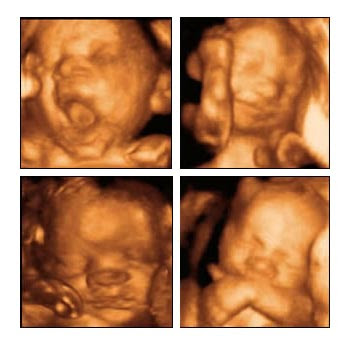 LA NUEVA CARAVANA: ECO 4D