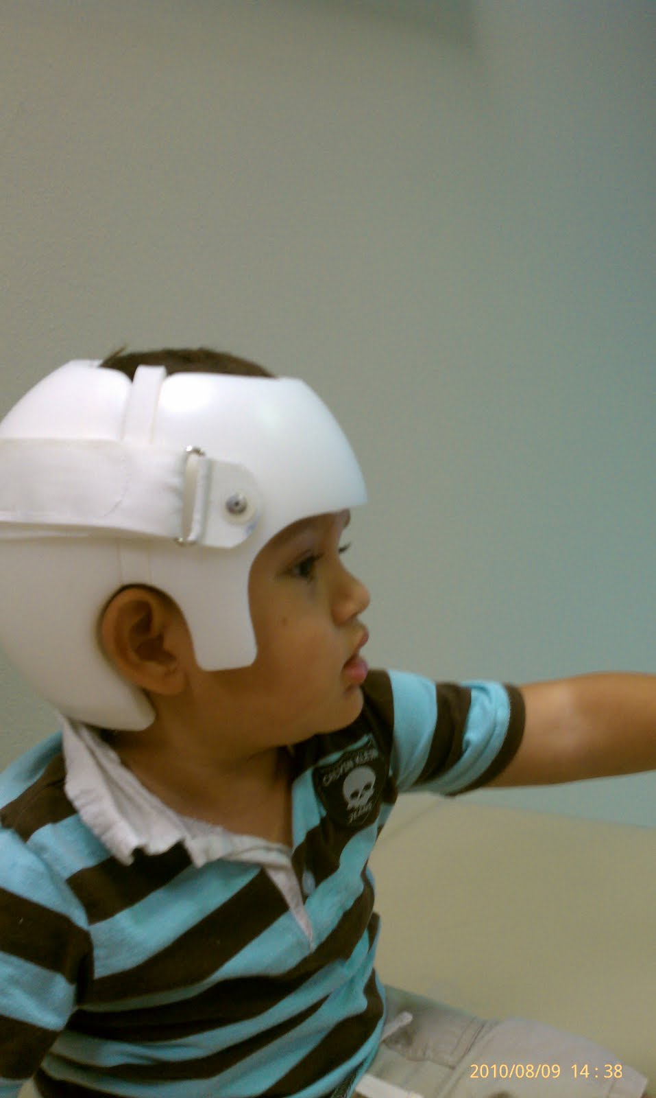 The Ornelas' Odyssey: Let the Helmet Therapy Begin