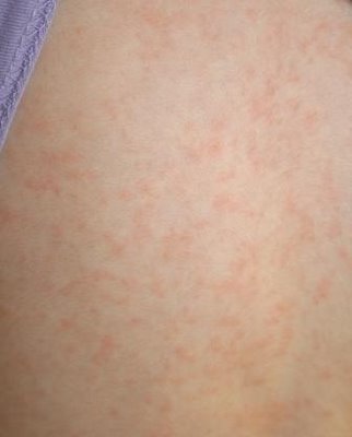 Lakeside Knitter: Roseola