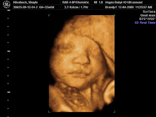 The Hilsabeck's: 8 months and 4D ultrasound