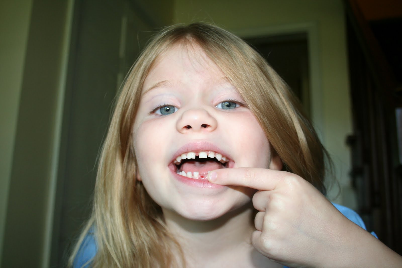 Whittsville: Lost Tooth