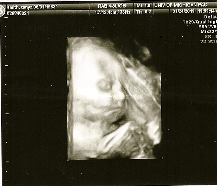 mamatots: 27 Weeks 4 Days - Ultrasound Check