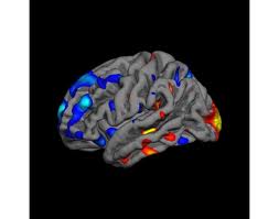 The Autism Angle: Diagnosing Autism with 90% Accuracy Through Brain Scans